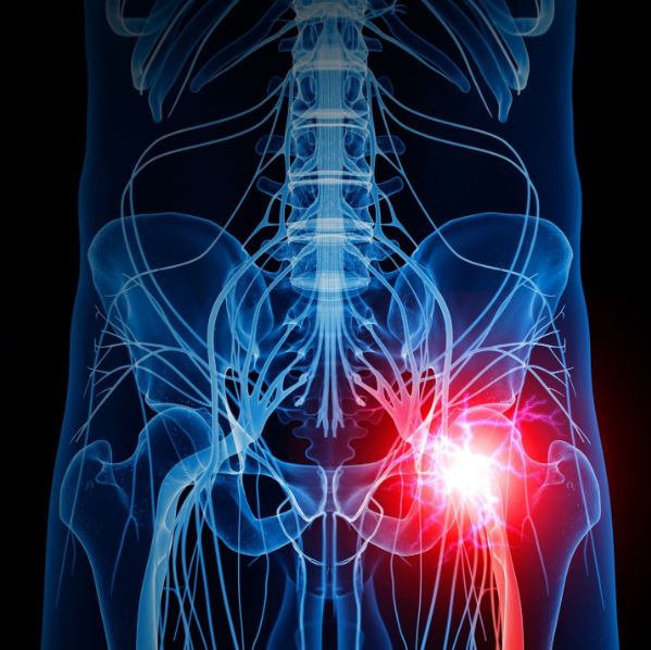 Sciatica: Understanding Its Causes and How Chiropractic Care May Help ...